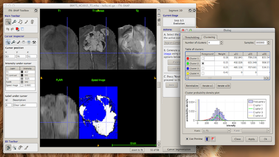 ITK-SNAP官网版下载-ITK-SNAP汉化下载 - 中华网软件