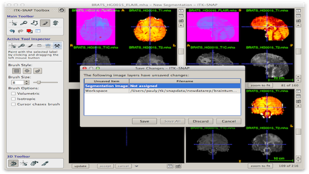 ITK-SNAP官网版下载-ITK-SNAP汉化下载 - 中华网软件